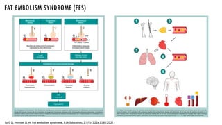 Fat Embolism Syndrome From Orthobullet.pptx