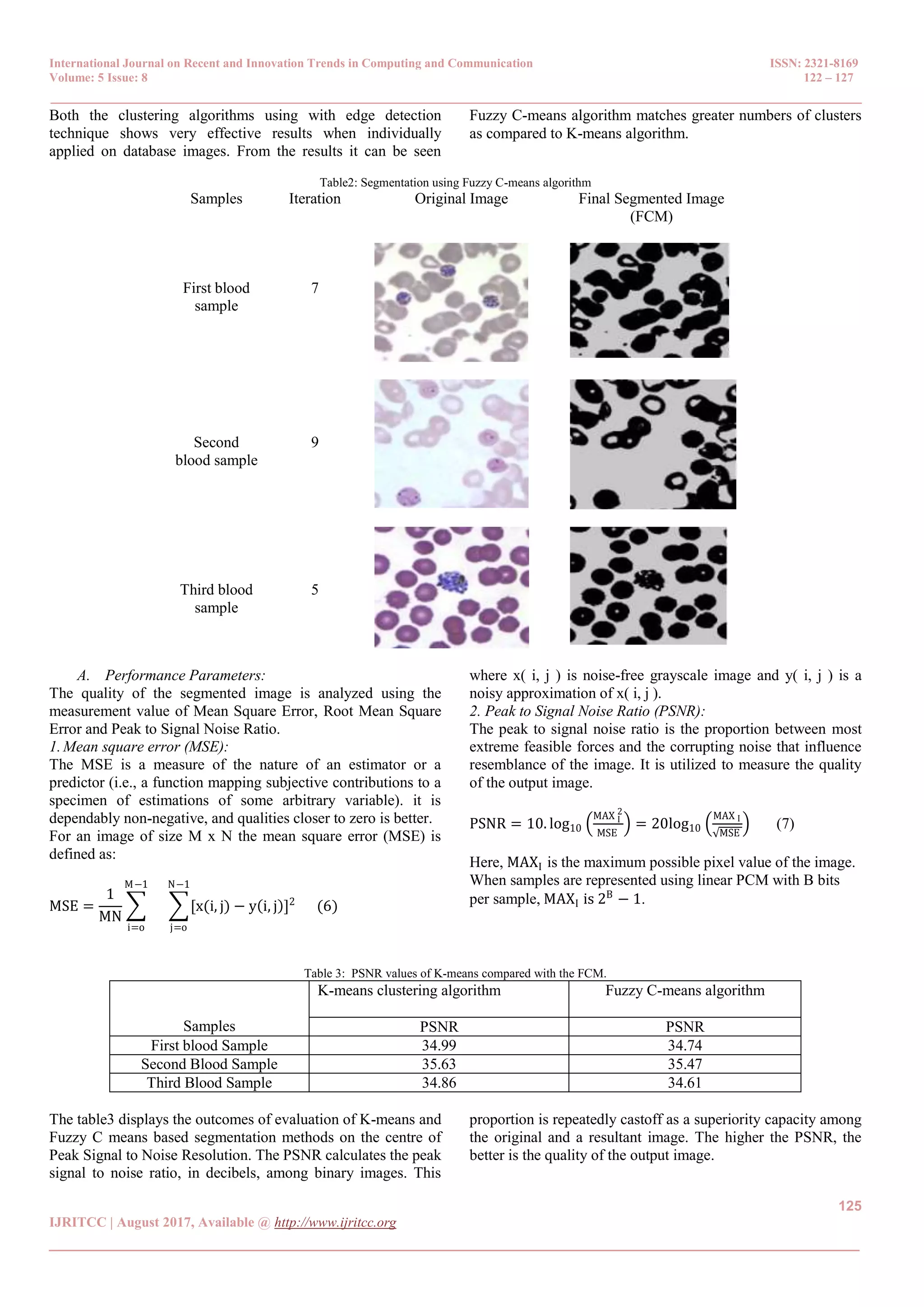 Illustration of Medical Image Segmentation based on Clustering Algorithms | PDF