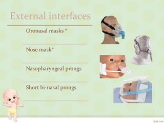 Noninvasive ventilation in neonates | PPT