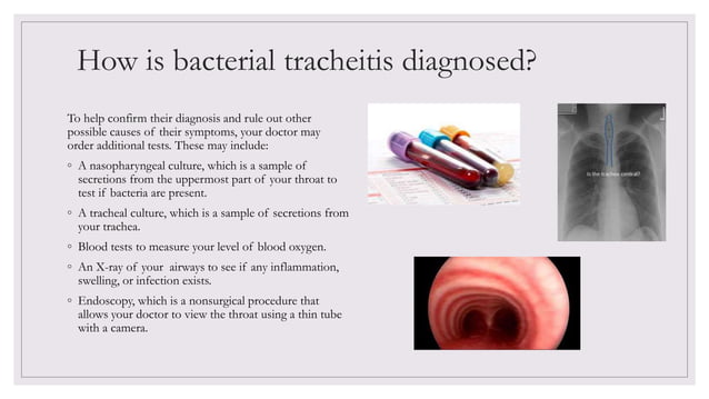 Tracheitis.......ppt
