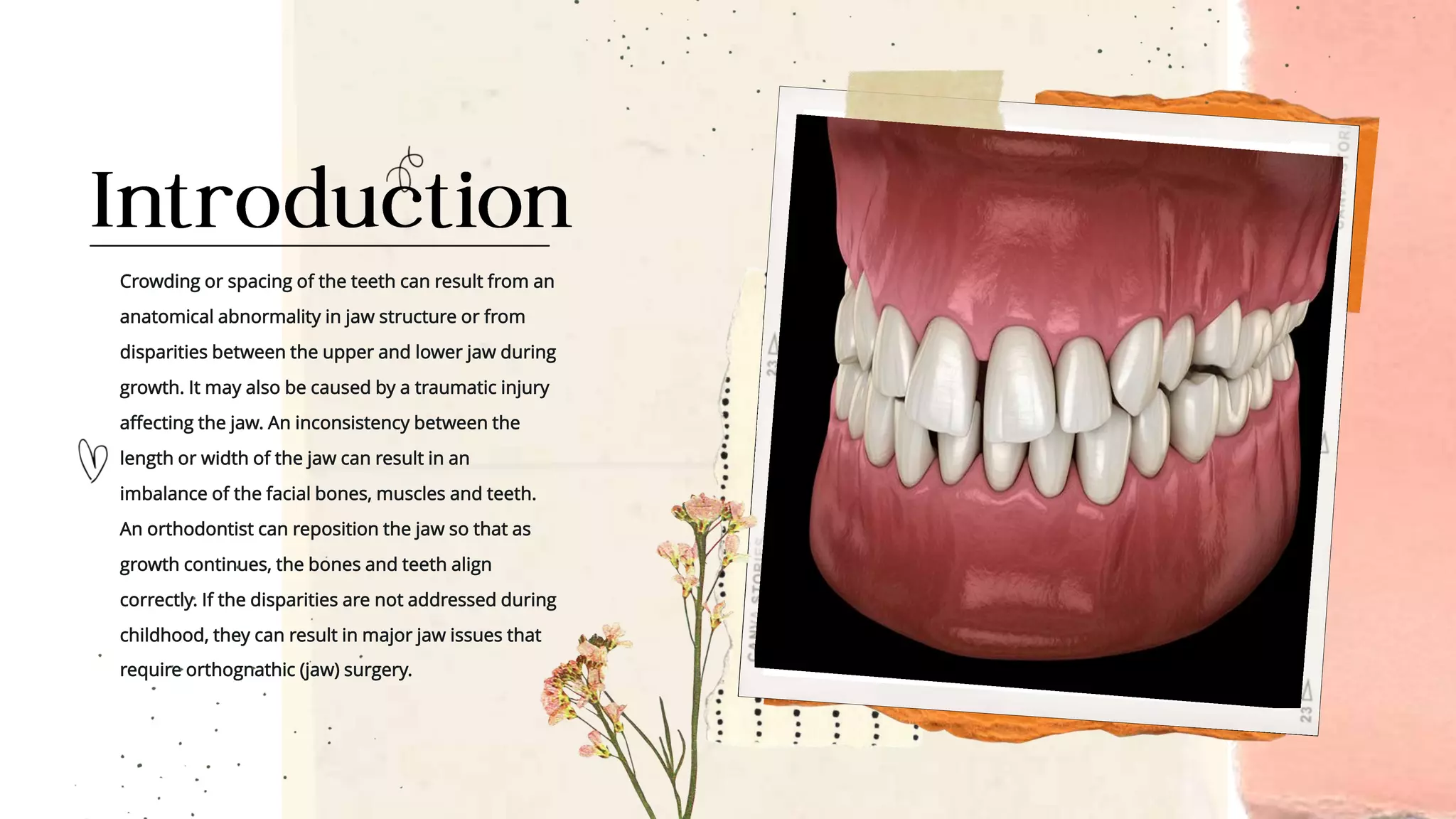 spacing and crowding of teeth | PPTX