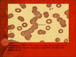 erythrocyte sedimentation rate | PPT
