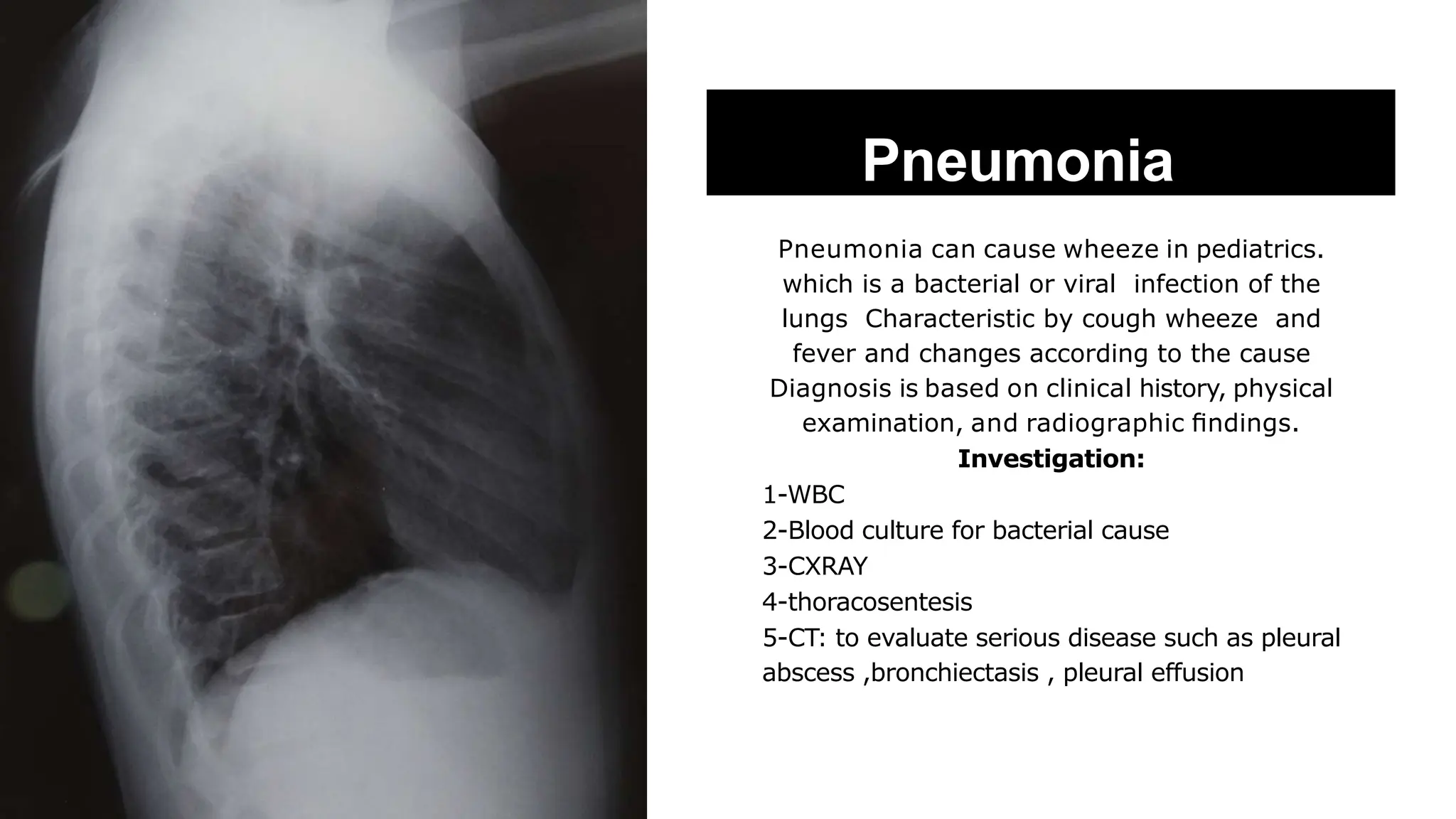 Wheeze chest in Pediatric | PPTX