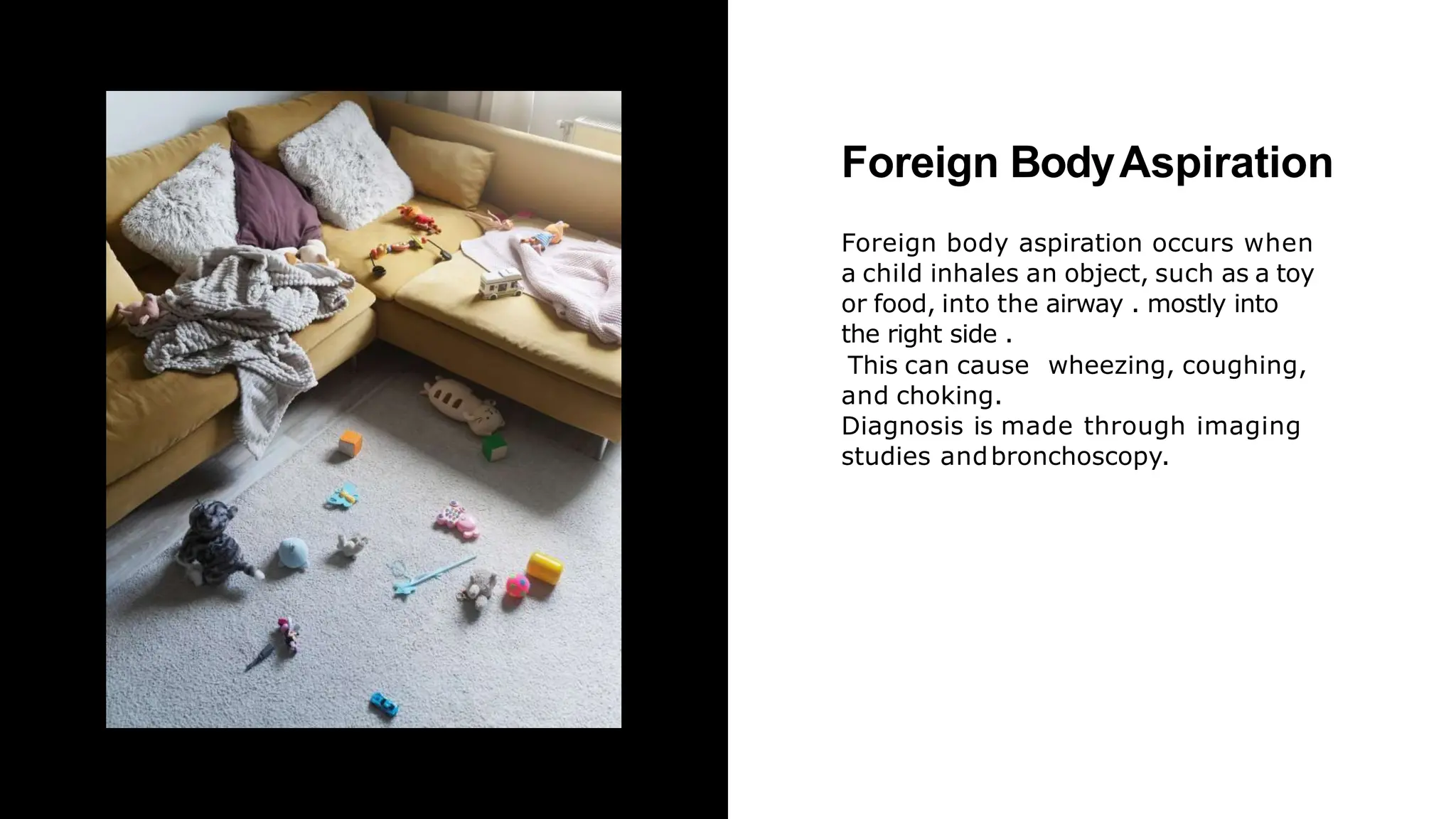 Wheeze chest in Pediatric | PPTX