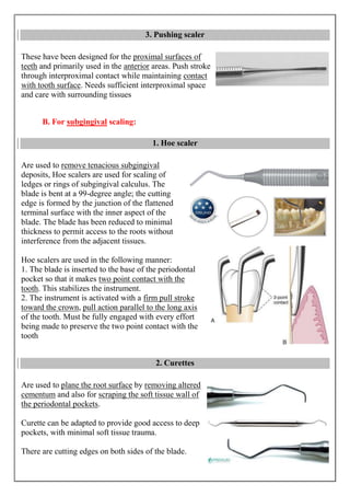 Periodontal instruments | PDF