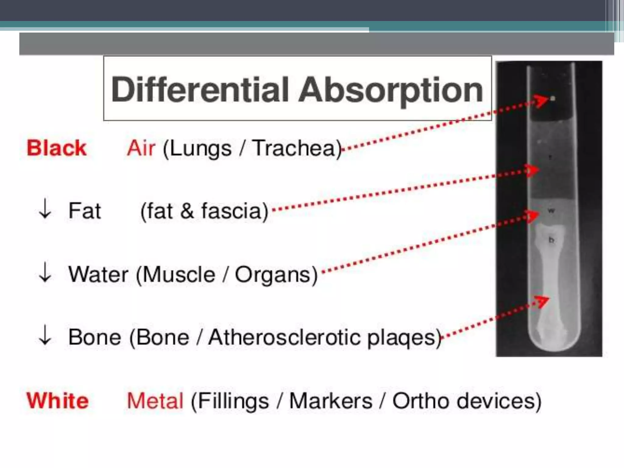 X-RAY BASICS | PPTX