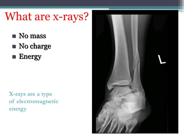 X-RAY BASICS | PPTX