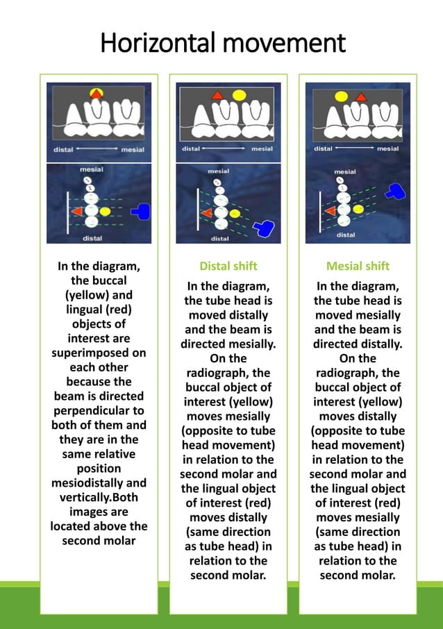 Localization Technique | PDF | Dental Health | Diseases and Conditions