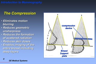 25632789 01-basics1-advanced-mammo-system | PPT