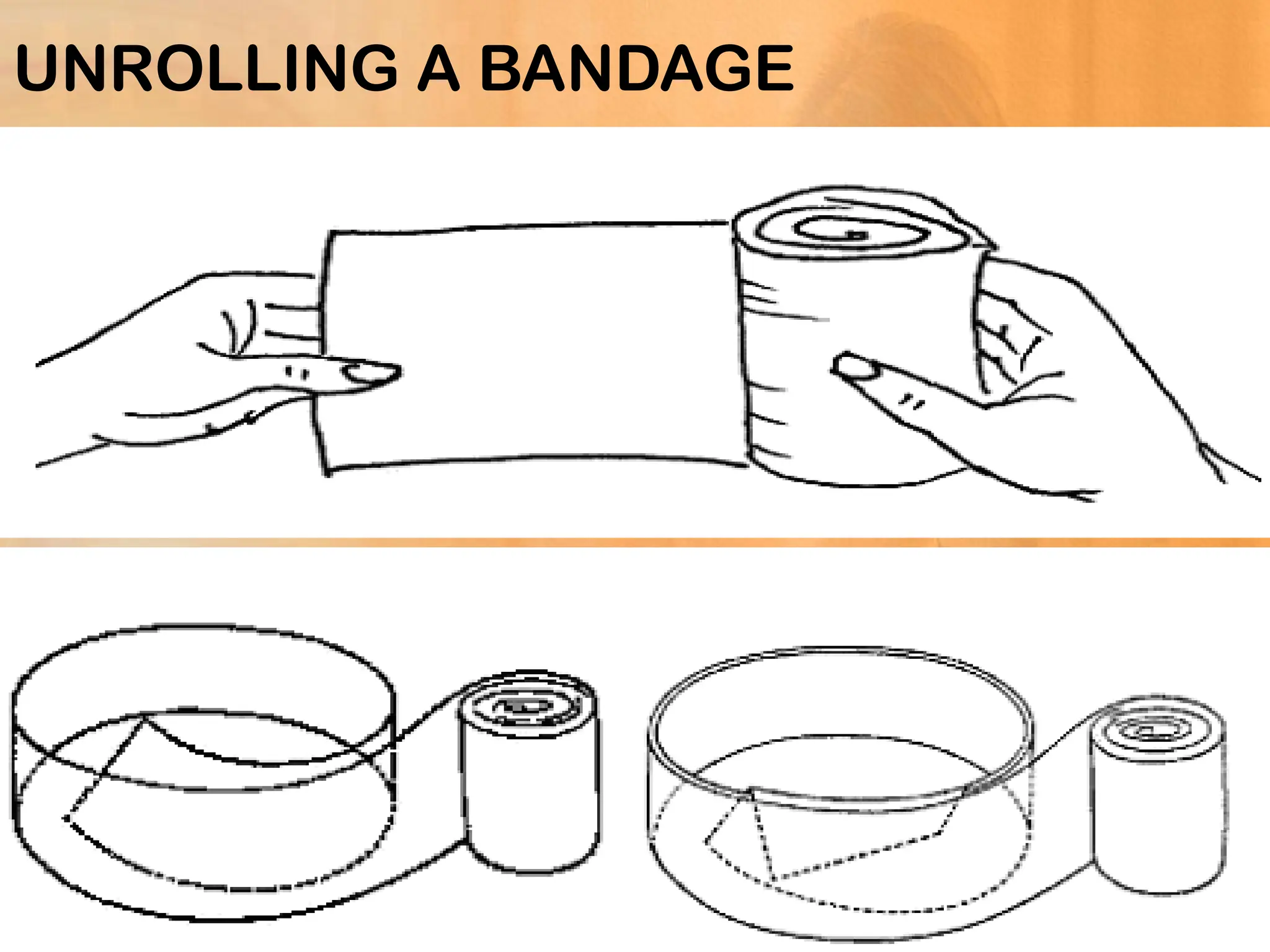 BANDAGING- bandaging types, processes.. | PPTX