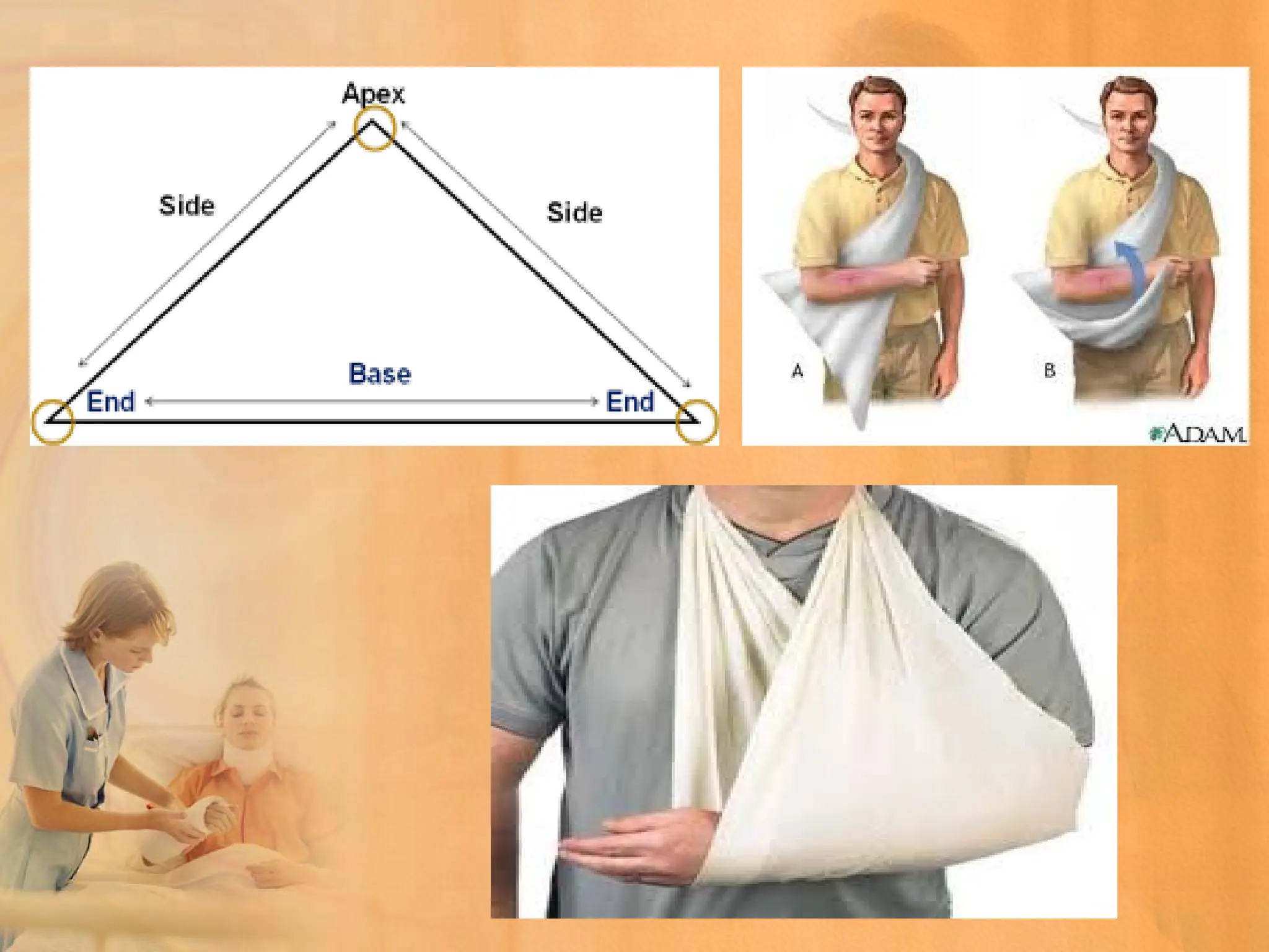 BANDAGING- bandaging types, processes.. | PPTX