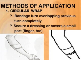 BANDAGING- bandaging types, processes.. | PPTX