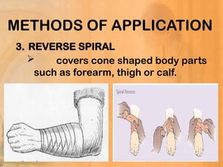BANDAGING- bandaging types, processes.. | PPTX