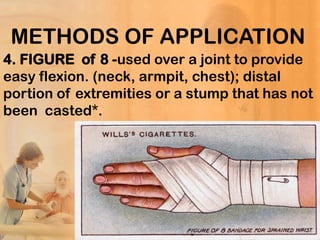 BANDAGING- bandaging types, processes.. | PPTX