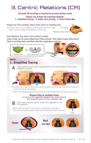 2567 pala digital_dentures_manual_v3_singles | PDF | Dental Health ...