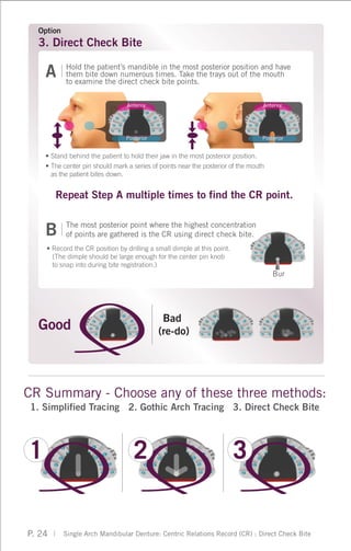 2567 pala digital_dentures_manual_v3_singles | PDF | Dental Health ...