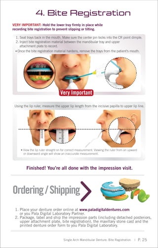 2567 pala digital_dentures_manual_v3_singles | PDF