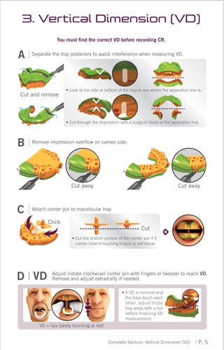 2567 pala digital_dentures_manual_v3_singles | PDF | Dental Health ...