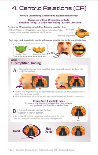 2567 pala digital_dentures_manual_v3_singles | PDF | Dental Health ...