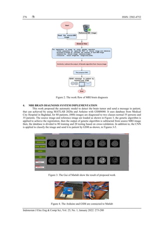 The IoT and registration of MRI brain diagnosis based on genetic algorithm and convolutional ...