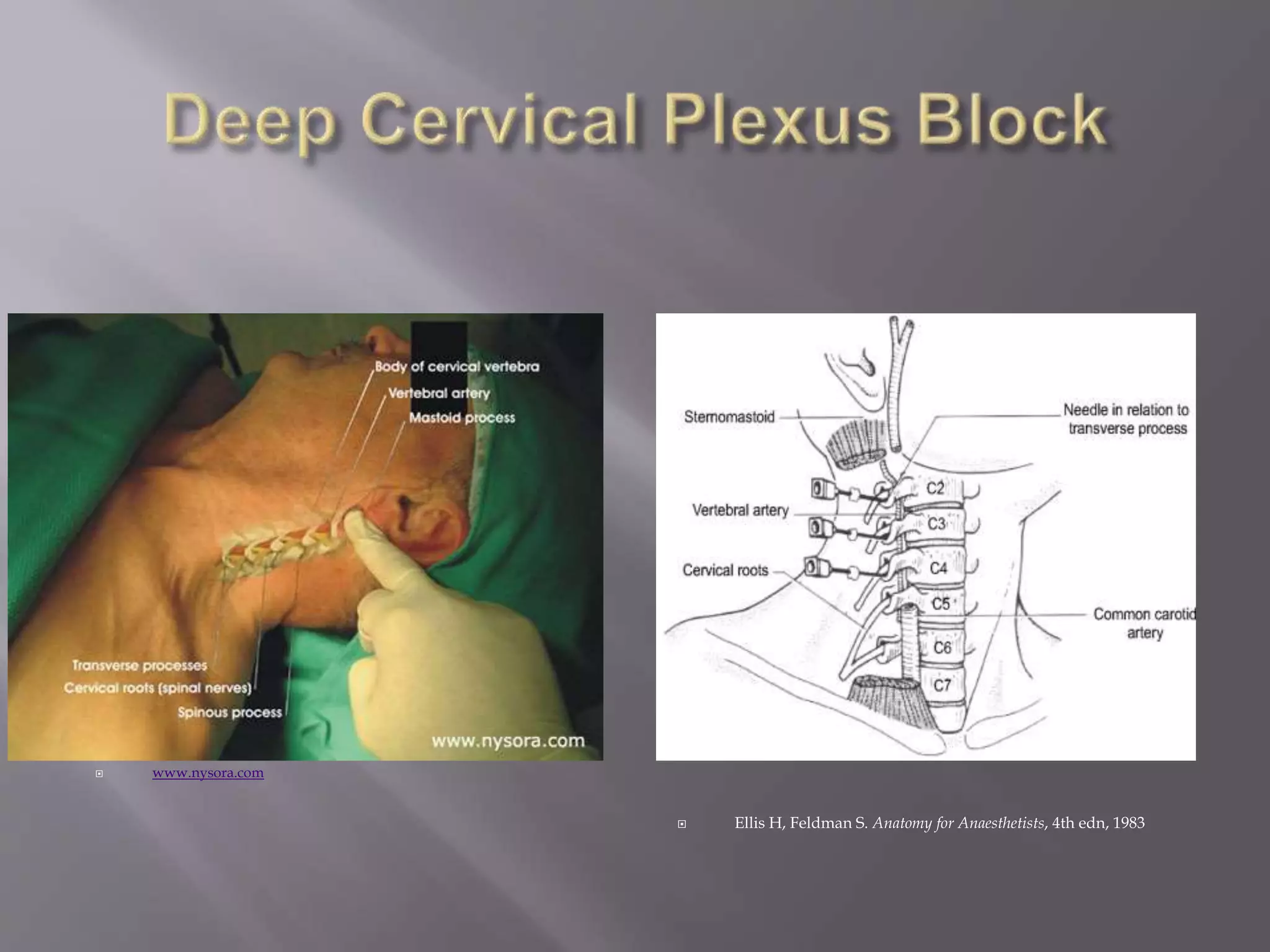 25820 - Cervical Plexus Block (1).pptx