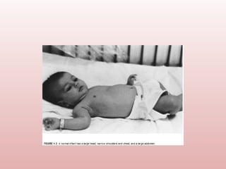 2588307306-Pediatric-Anesthesia-ppt.pptx