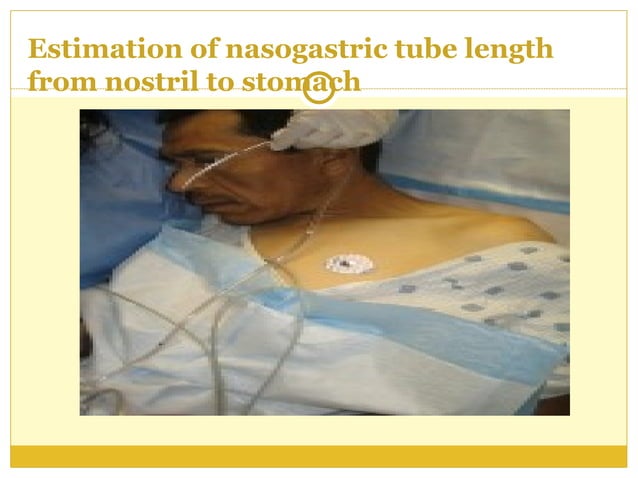 259153869-Procedure-of-Inserting-nasogastric-tube-ppt.ppt