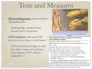 Guillain-Barre Syndrome final | PDF