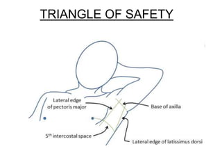 Tension pneumothorax | PPTX