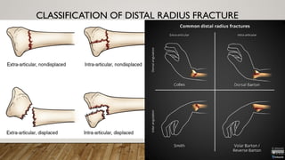 25 DISTAL RADIUS FRACTURE.pptx free download | PPT