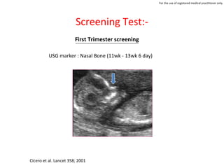 Investigations in First Trimester Pregnancy | PPT