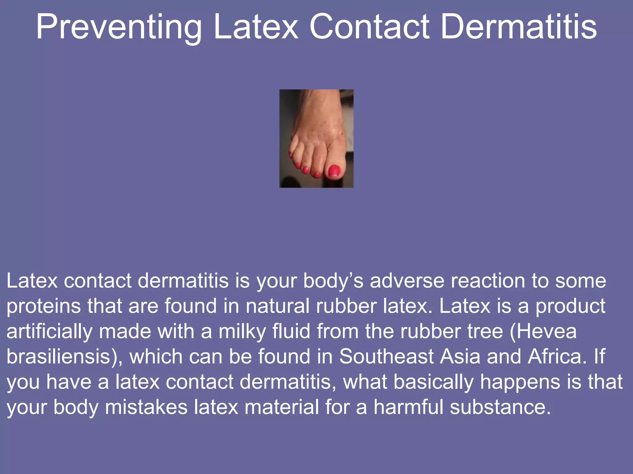 Preventing Latex Contact Dermatitis | PPT