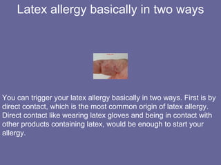 Preventing Latex Contact Dermatitis | PPT