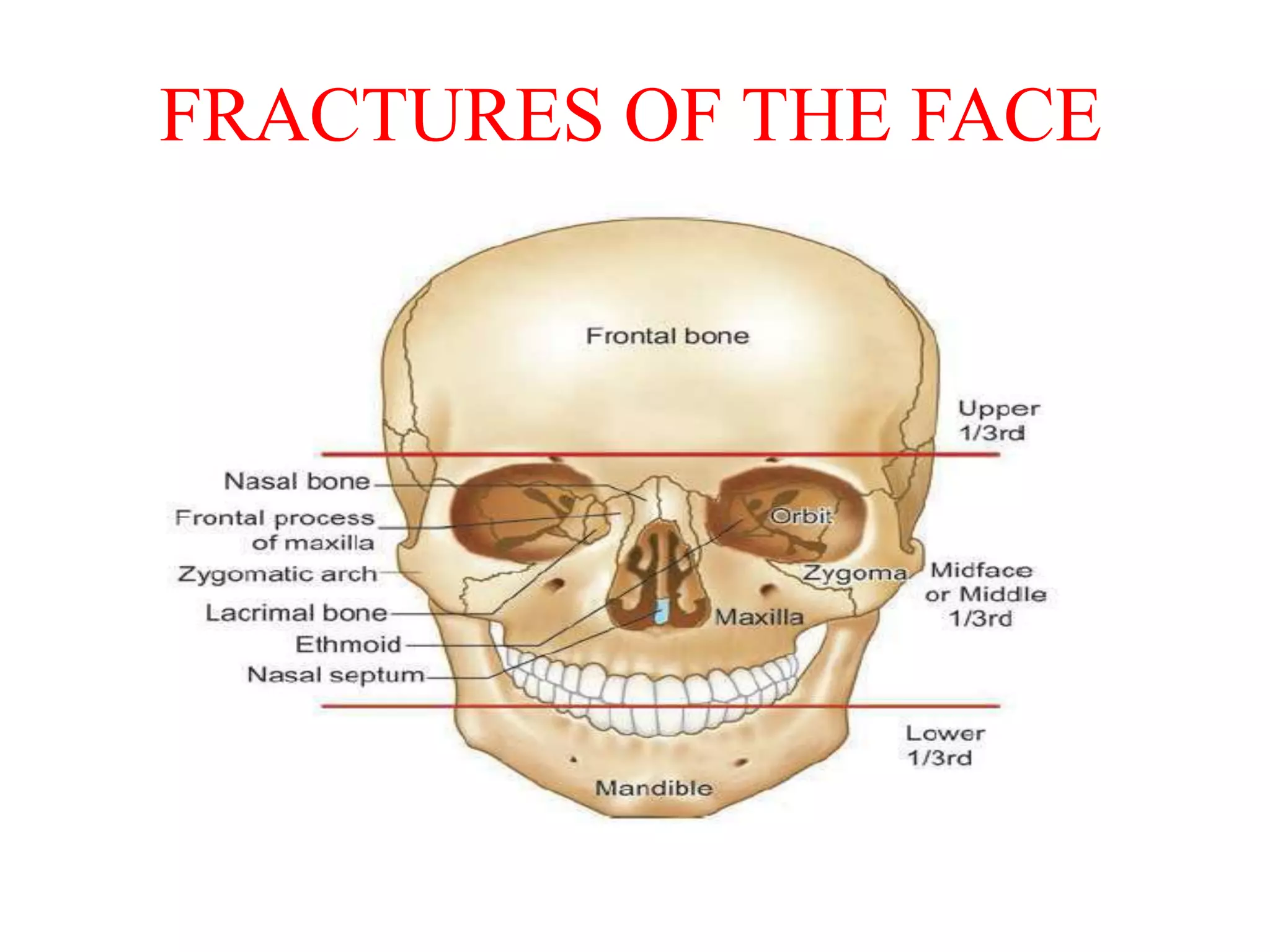 maxillofacial trauma | PPTX