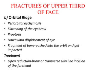 maxillofacial trauma | PPTX