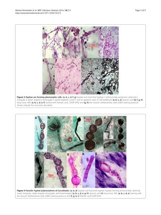 parasitic polymorphism coccidioides spp | PDF