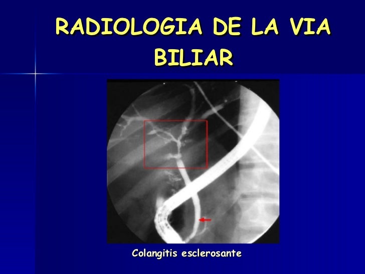 25 Radiologia De La Via Biliar