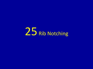 25 rib notching | PPTX