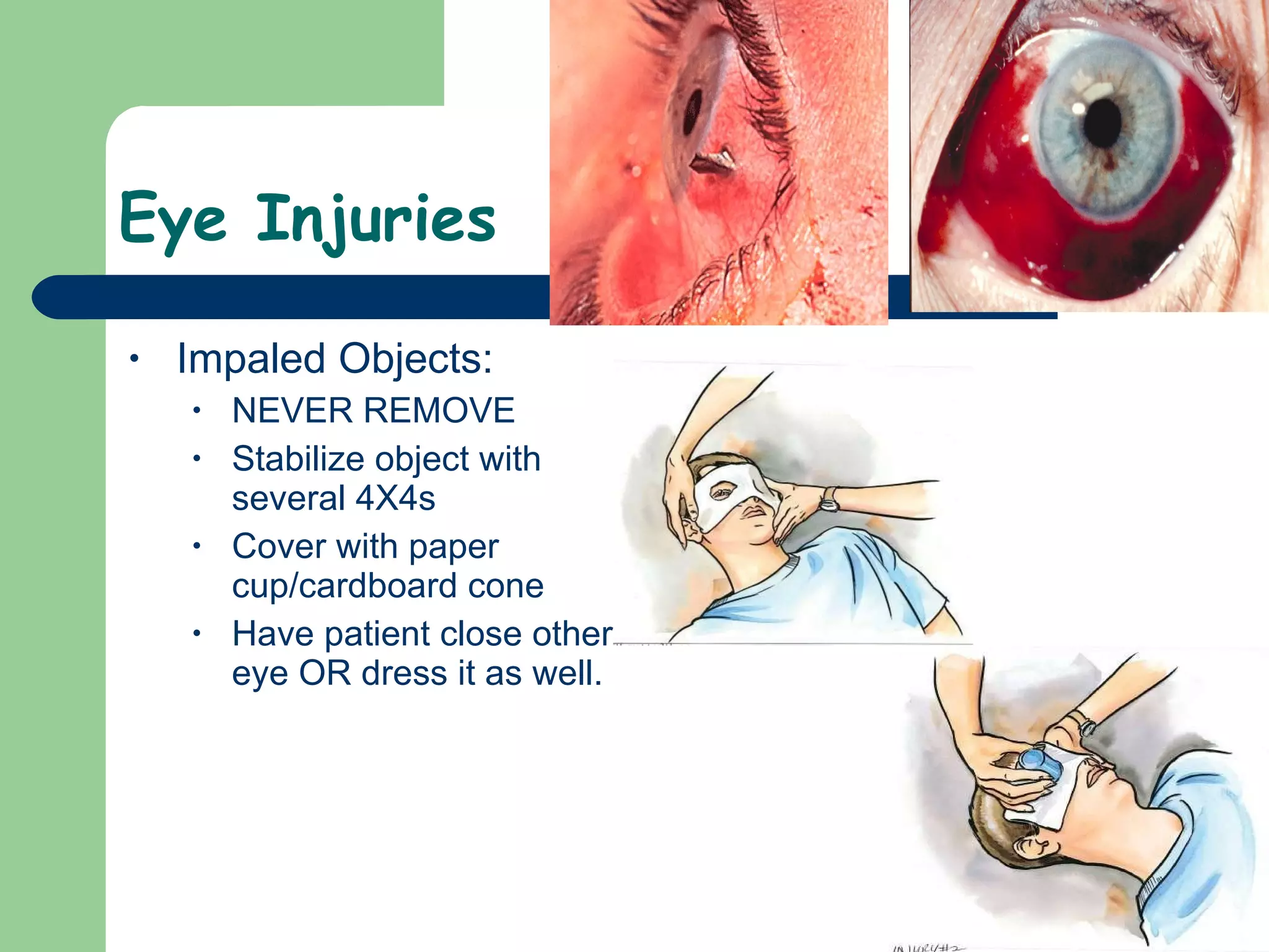 25)Soft Tissue Injuries | PPT