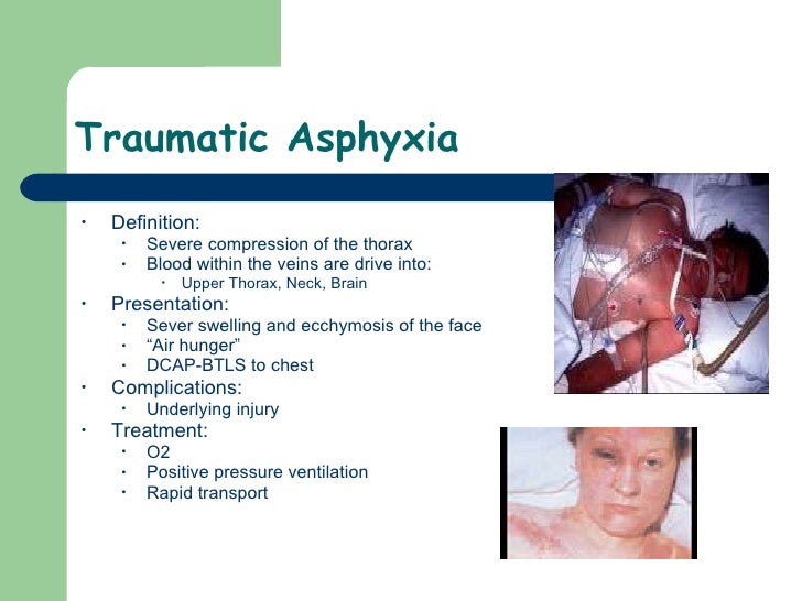 Traumatic Asphyxia