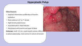 25th Gastrointestinal polyp Finals .pptx