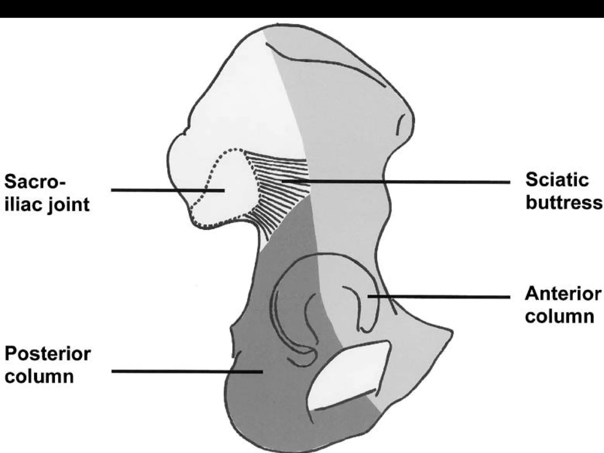 26. acetabular fractures anatomy, evaluation and classification ...
