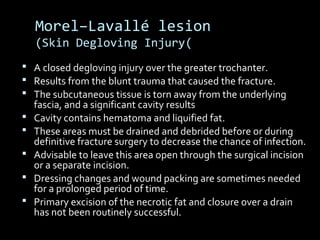 26. acetabular fractures treatment - muhammad abdelghani | PPT