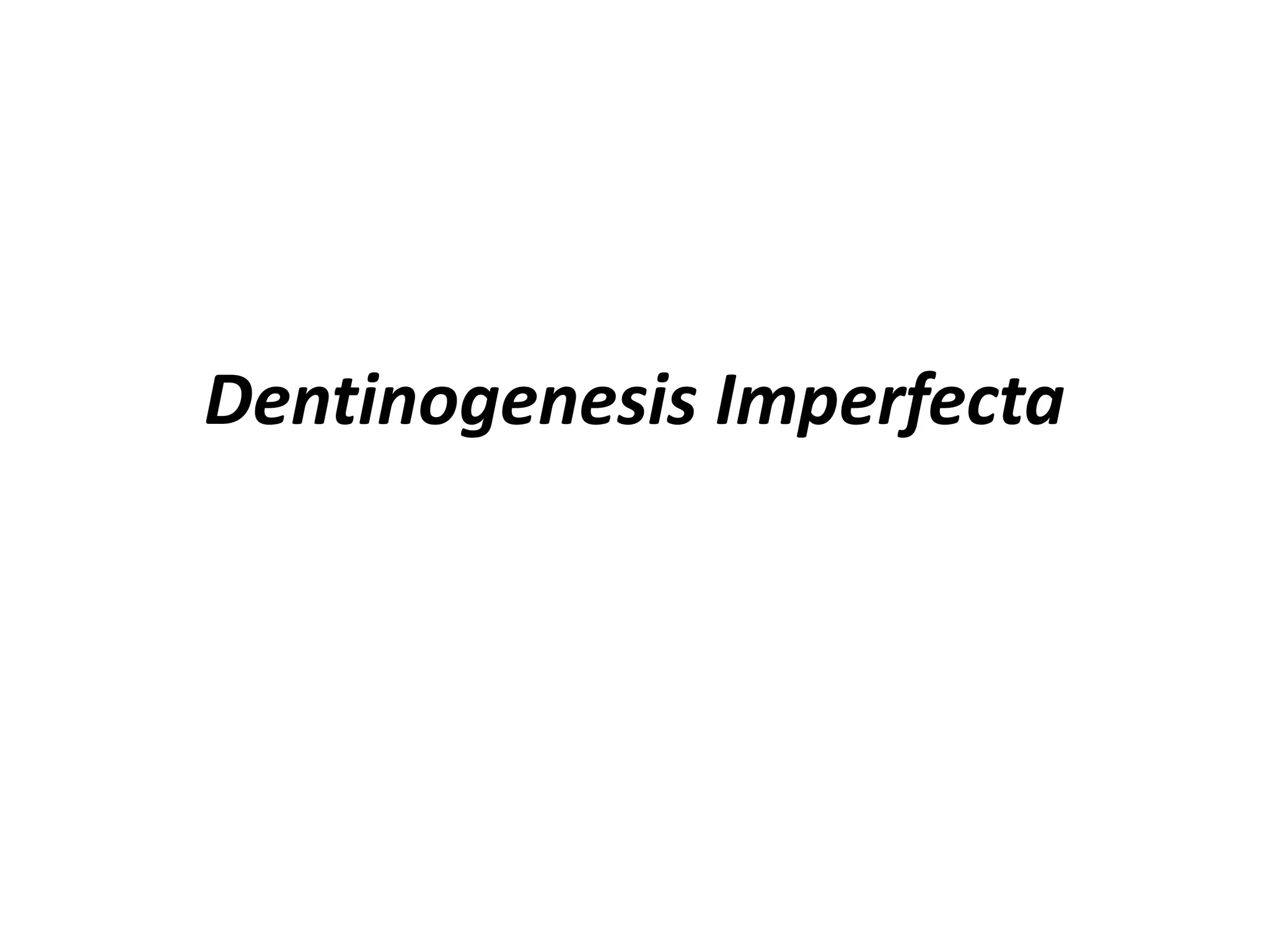 26.dentinogenesis imperfecta | PPTX