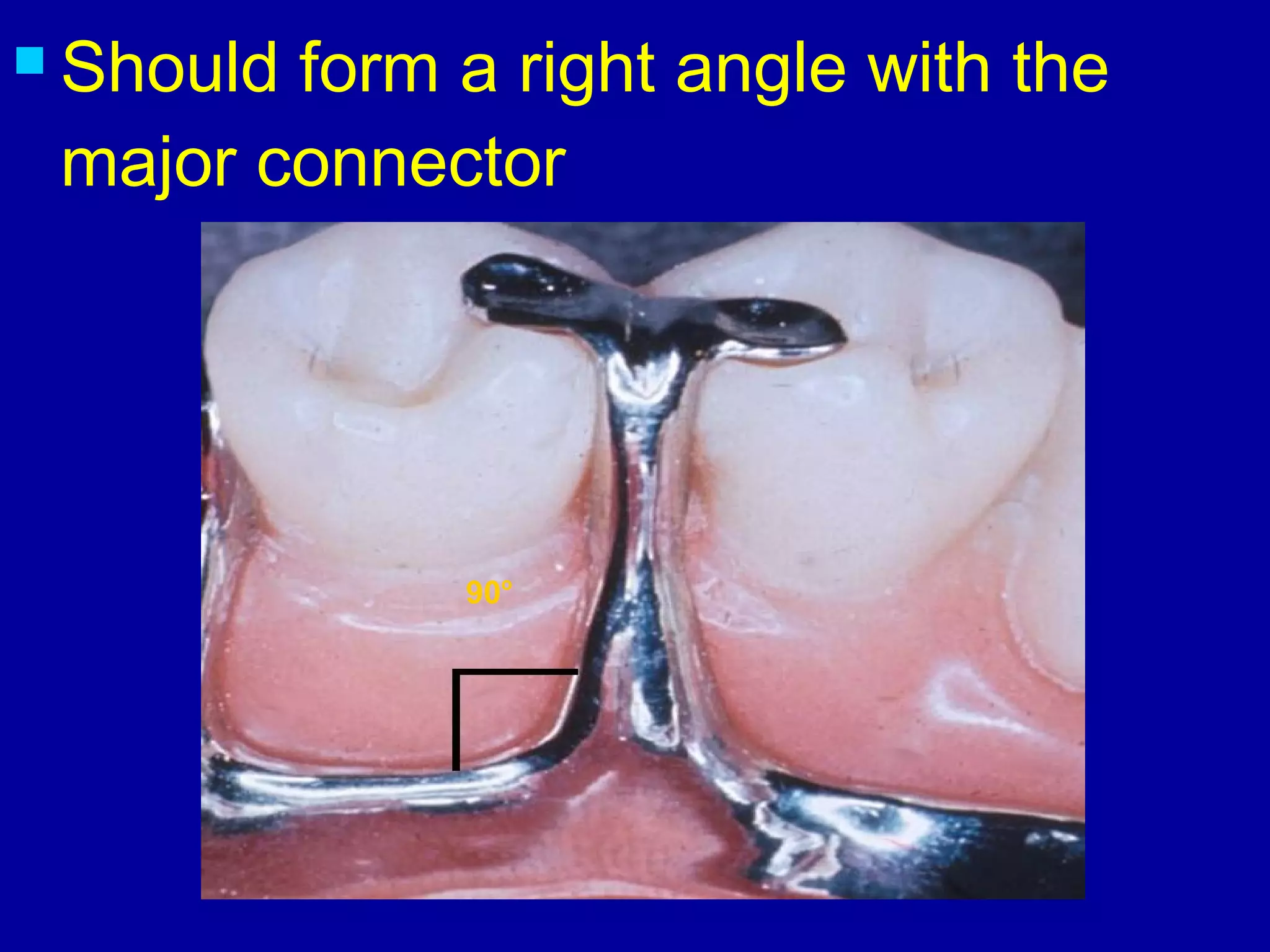 26. designing of rpd | PPT | Dental Health | Diseases and Conditions