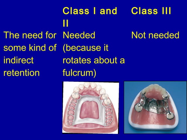 26. designing of rpd | PPT | Dental Health | Diseases and Conditions