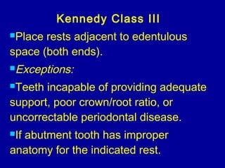 26. designing of rpd | PPT