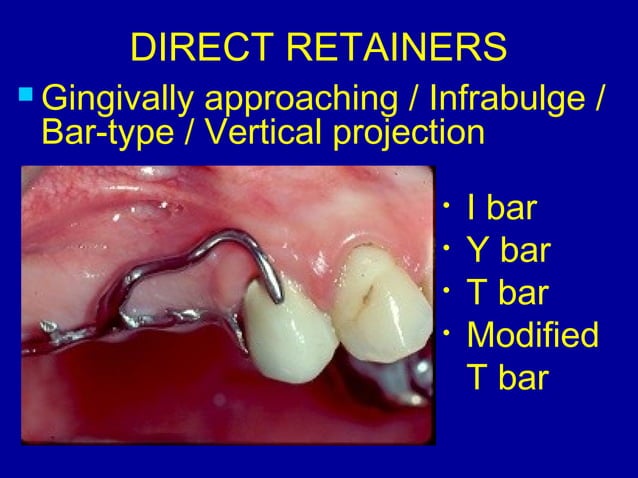 26. designing of rpd | PPT | Dental Health | Diseases and Conditions
