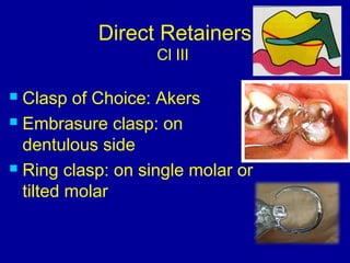 26. designing of rpd | PPT