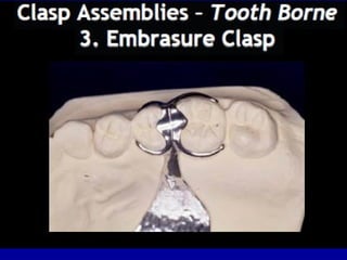 26. designing of rpd | PPT